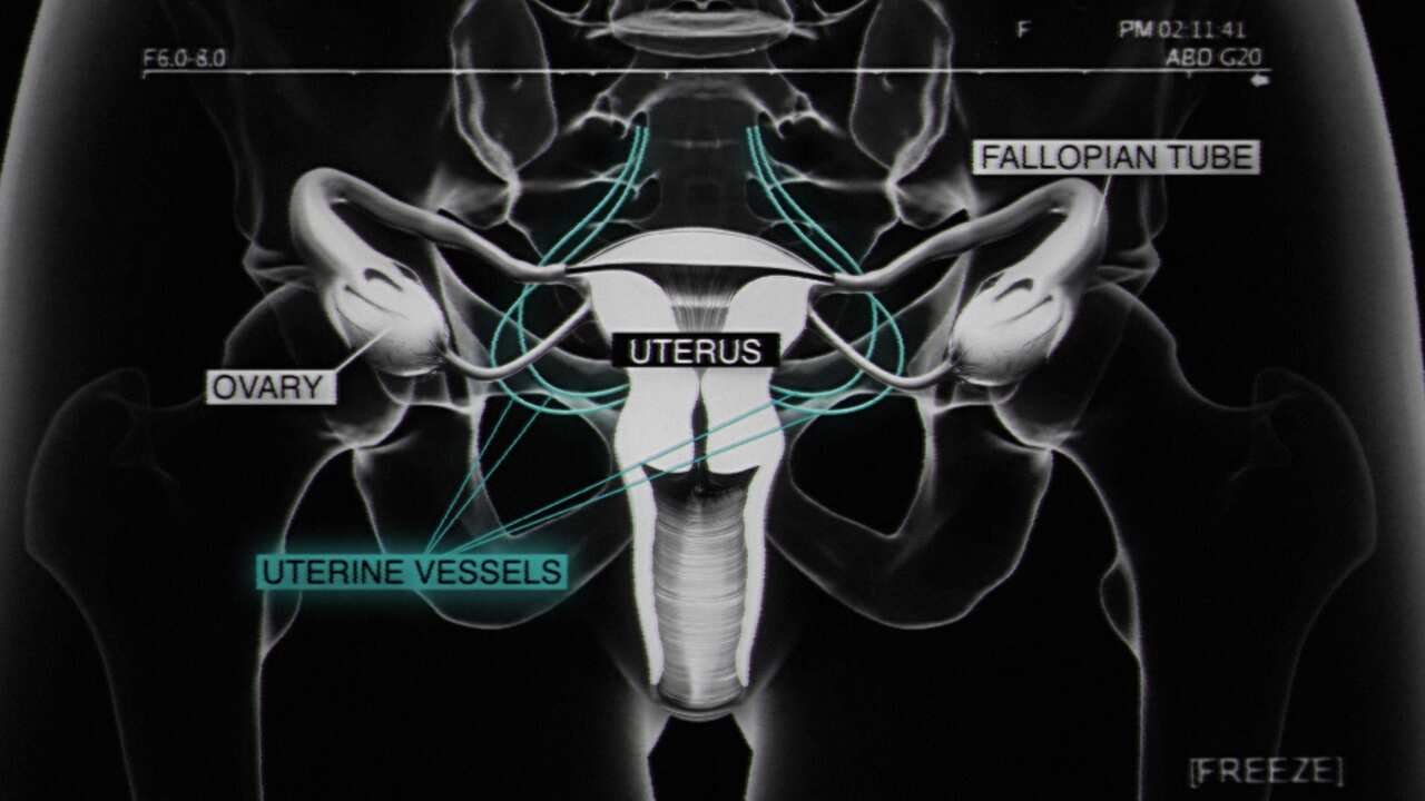 Changing Wombs: Could uterine transplants become a reality in Australia ...